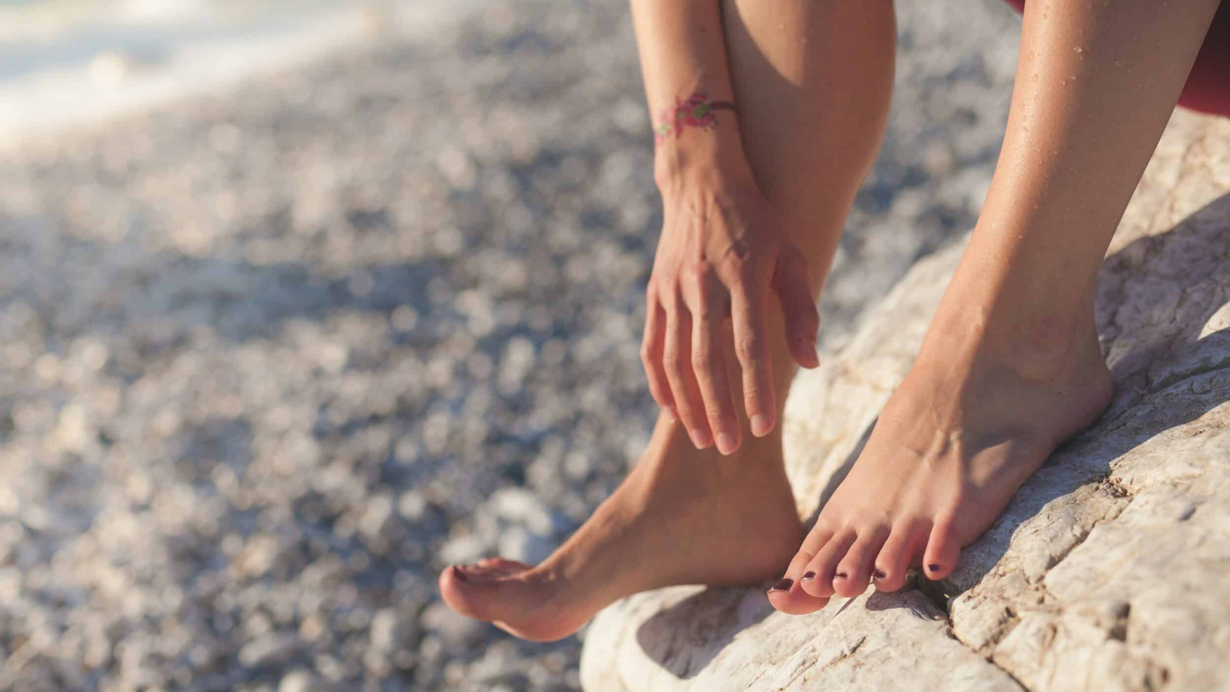 What To Do About Athlete’s Foot?